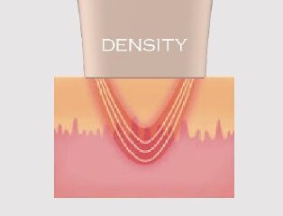 DENSITY（デンシティ） - 京都の美容外科・美容皮膚科｜医療法人京美会 烏丸御池ビューティークリニック